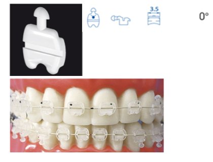 Brackets p/cementar Natura RICKETTS 018 Nº14/24 10pzas